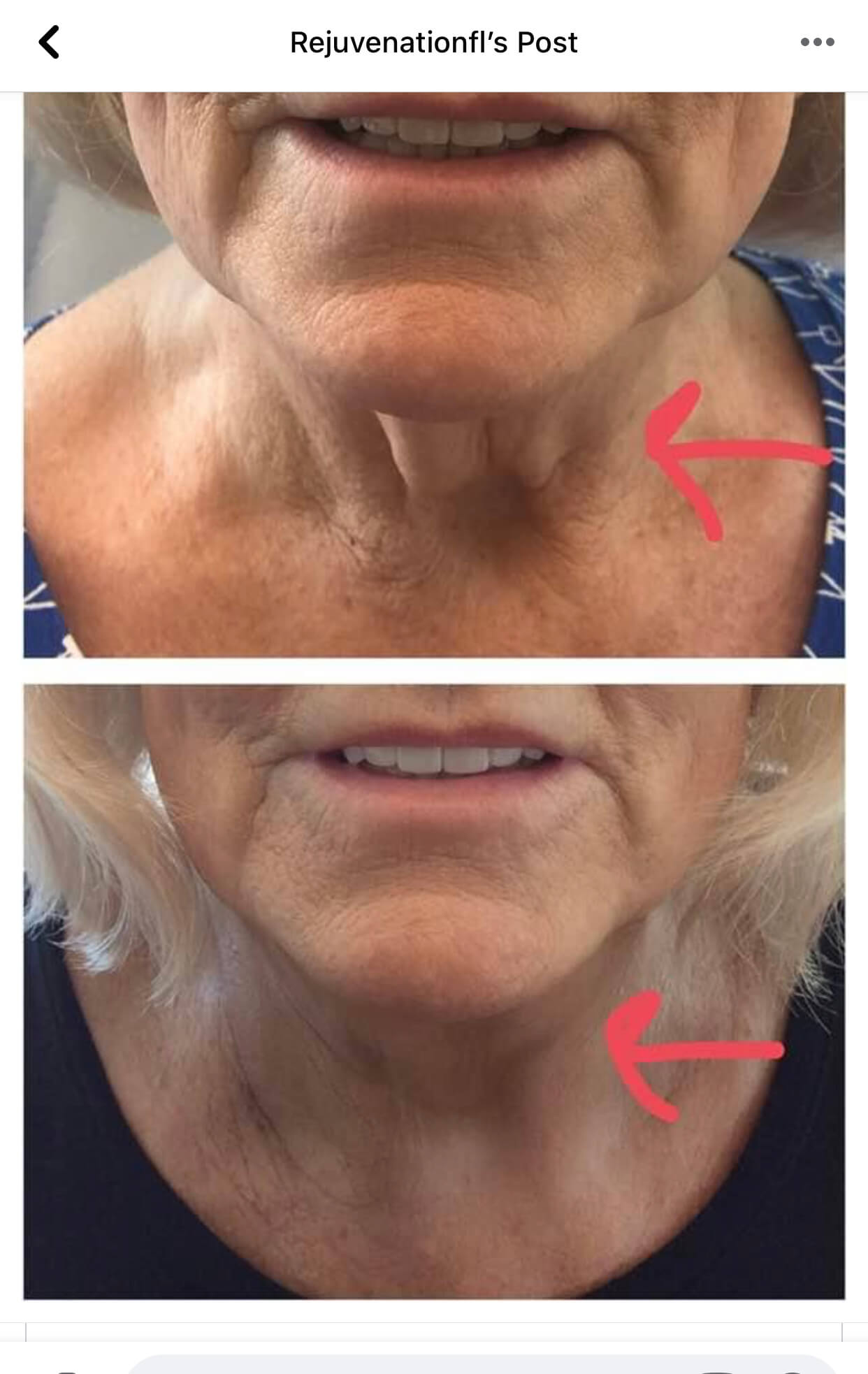 Results - rejuvenationfl