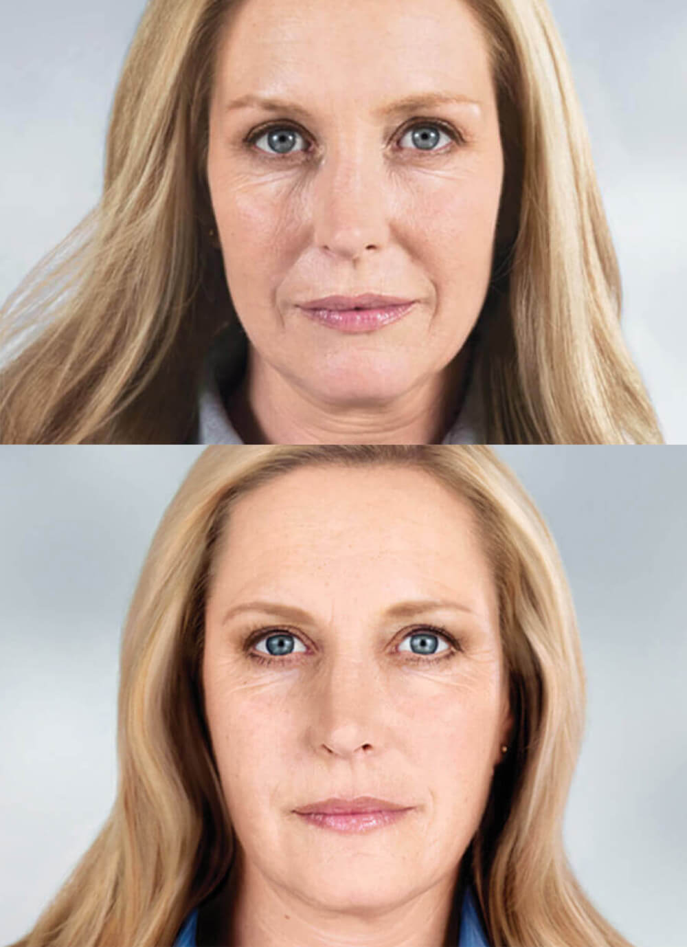 Results - rejuvenationfl